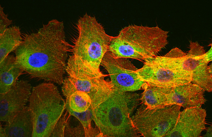 Cells move en masse towards rigid tissues - Institute for ...