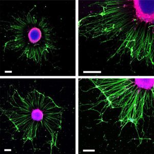 New evidence for the role of proprioceptive sensory neurons in ALS ...