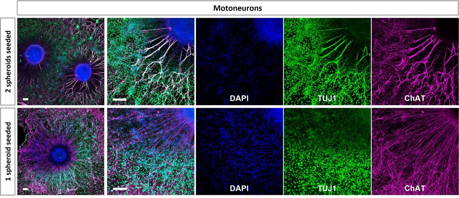 New evidence for the role of proprioceptive sensory neurons in ALS ...