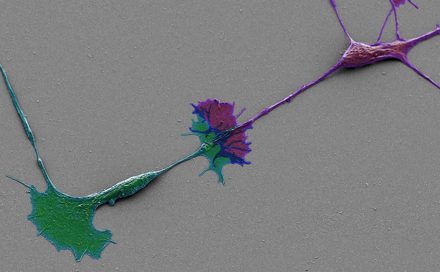Biomaterials for Neural Regeneration - Institute for Bioengineering of ...